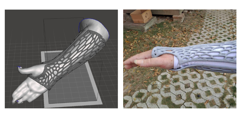 Innovating Prosthetics: Imrich Molnár's Journey with the Mole 3D ...